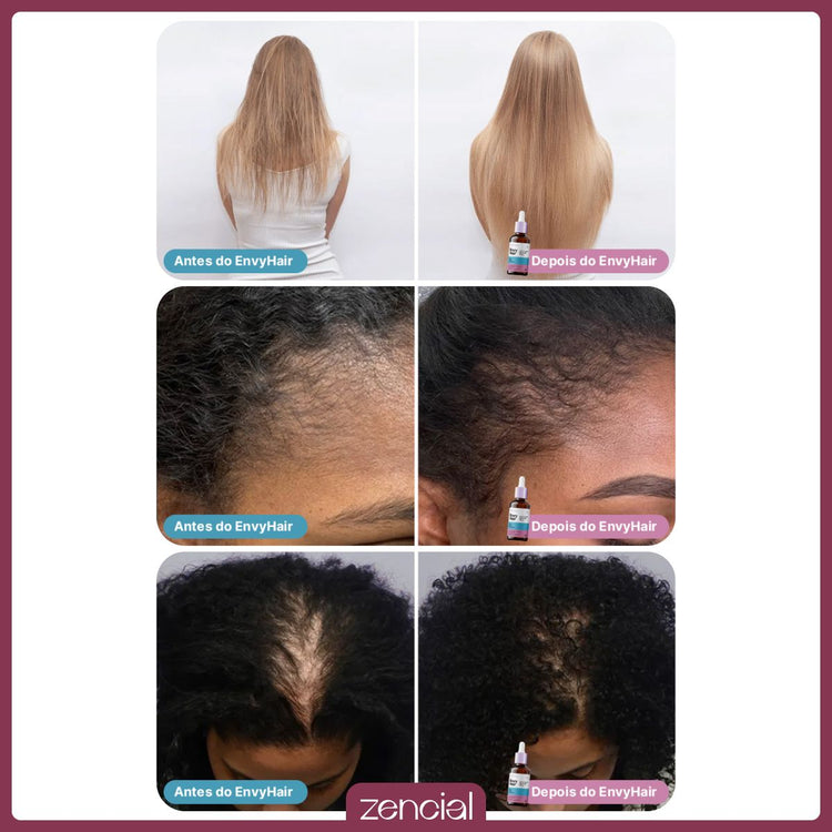 Oléo Capilar Envy Hair Sérum de Crescimento – Zencial